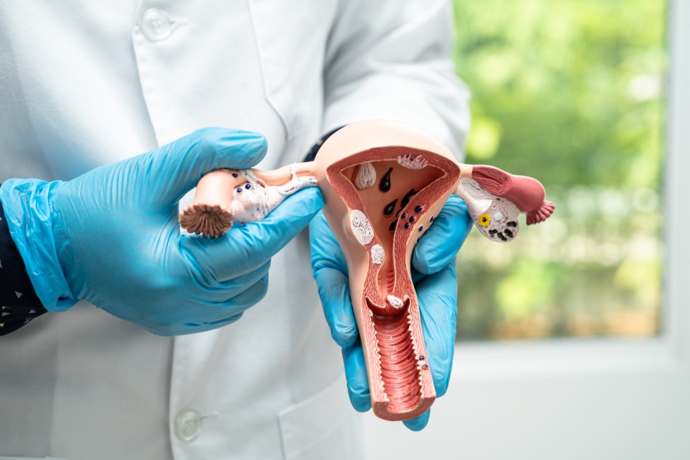 Advanced Endometriosis Surgeons - Endometriosis Help